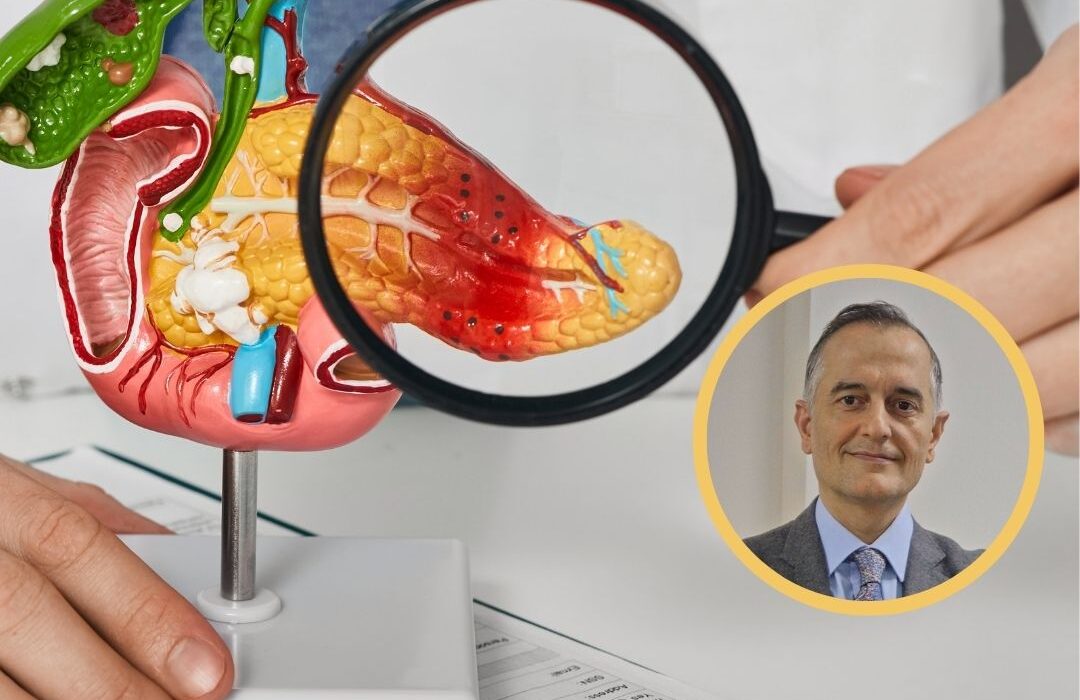 Akut pankreatit atağı nasıl önlenir? - Prof. Dr. Aydın Şeref Köksal